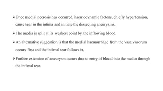 Aneurysms arterial swelling abnormality.pptx