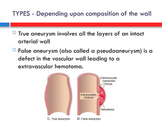 Aneurysms for MBBS AND PATHOLOGY students | PPTX