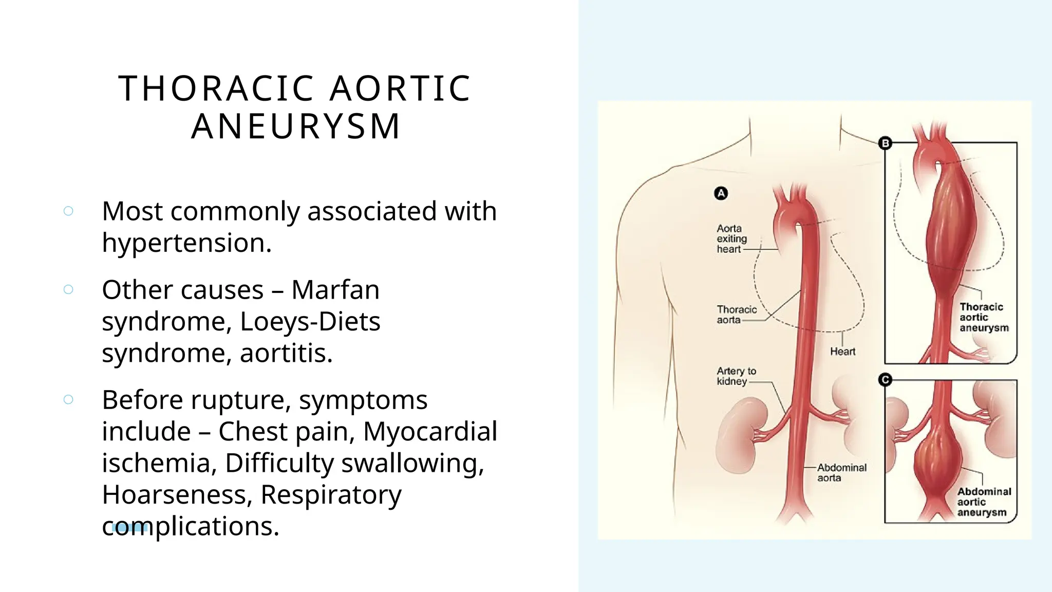 Aneurysms power point presentation_pathology | PPTX
