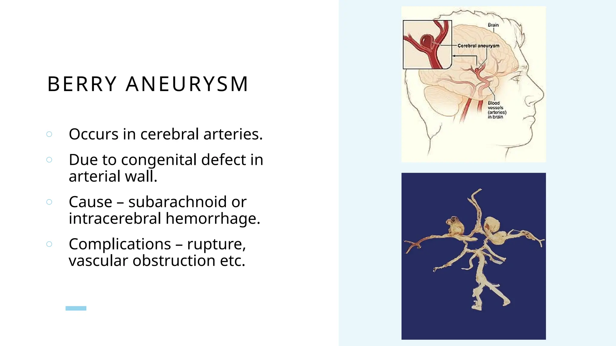 Aneurysms power point presentation_pathology | PPTX