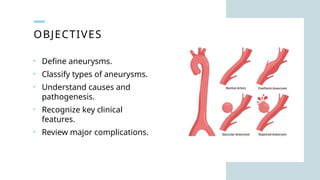 Aneurysms power point presentation_pathology | PPTX