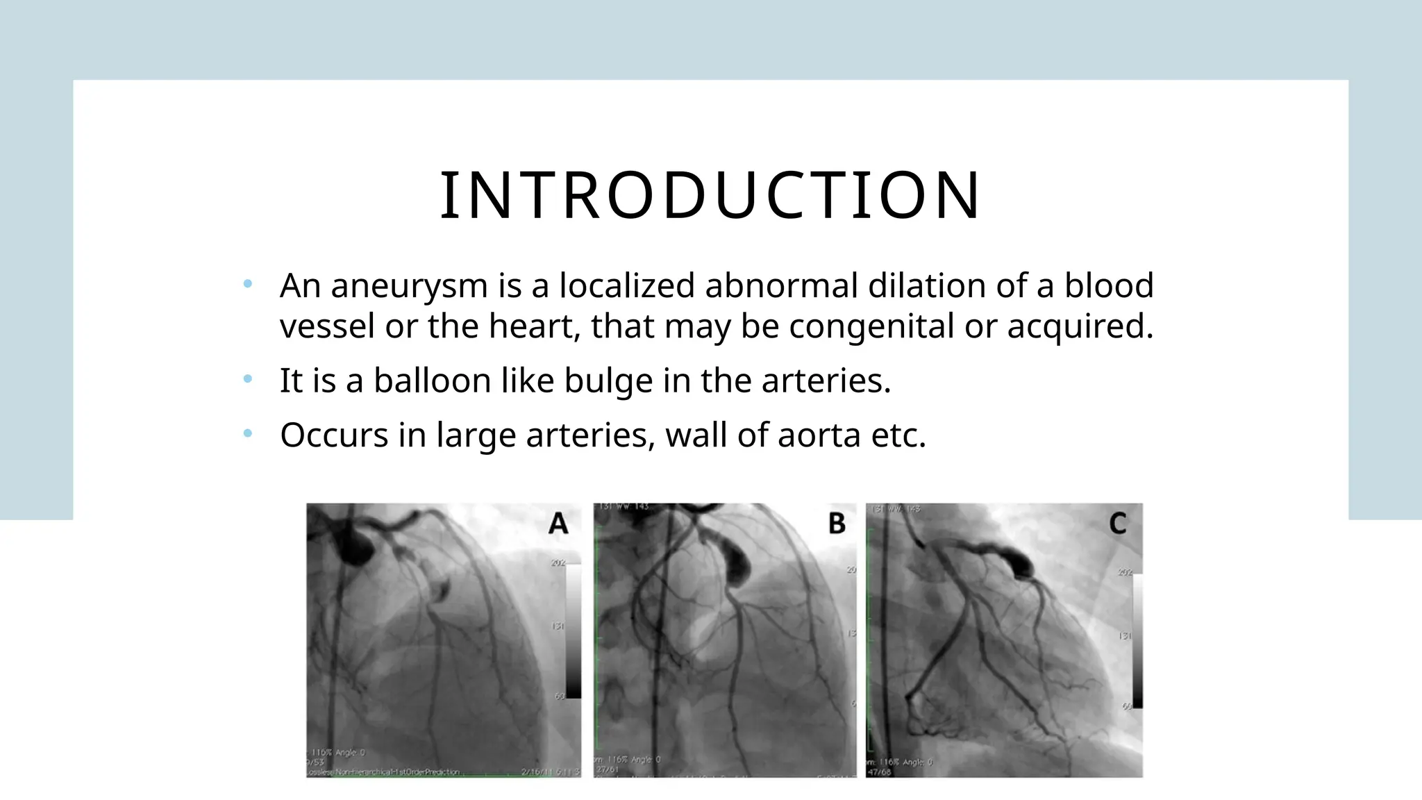 aneurysm ppt powerpoint pathology science | PPTX