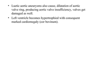 Aneurysms and dissections | PPT
