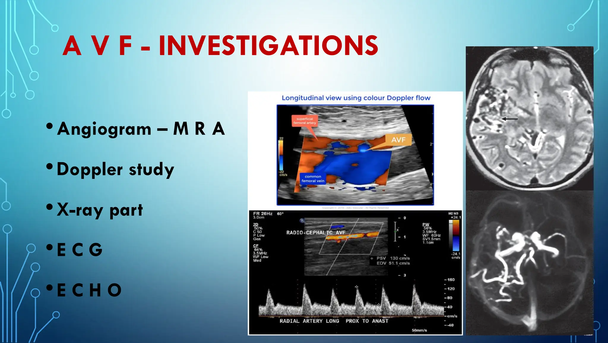 Aneurysms and Arterio-venous Fistula - PDF | PDF