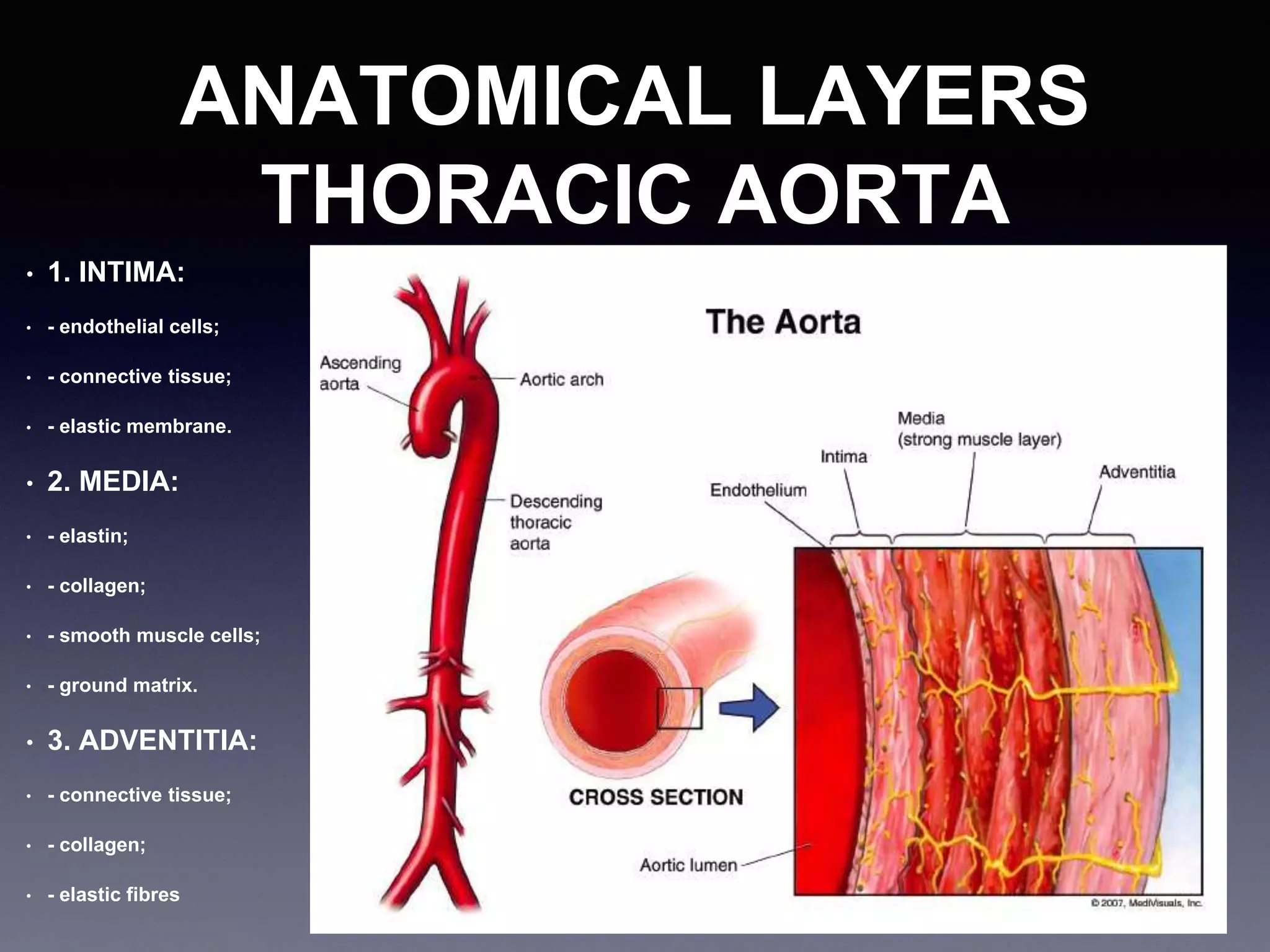 Aneurysms & dissections | PPTX