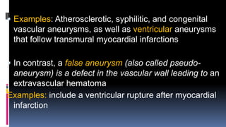Aneurysms lect 4 | PPT
