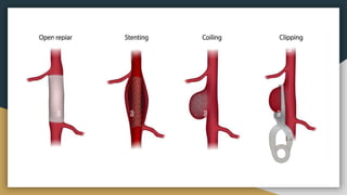 Aneurysms of the aorta and peripheral arteries..pptx