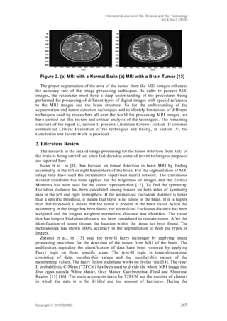 An evaluation of automated tumor detection techniques of brain magnetic ...
