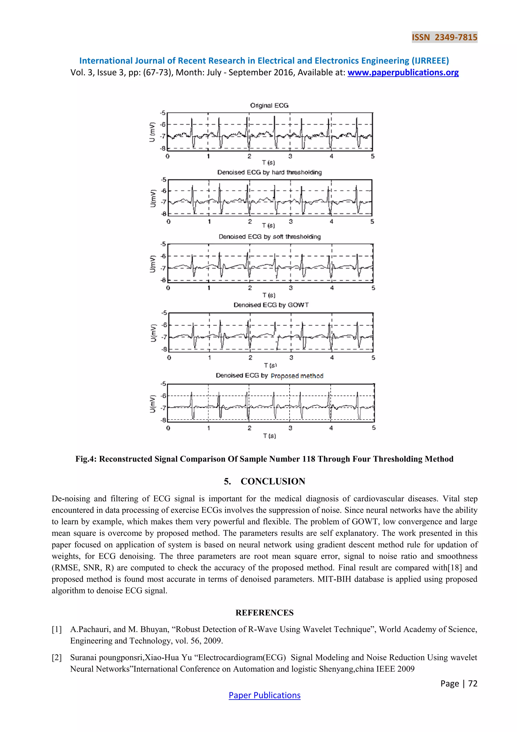 A new approach for Reducing Noise in ECG signal employing Gradient Descent Method by Artificial ...