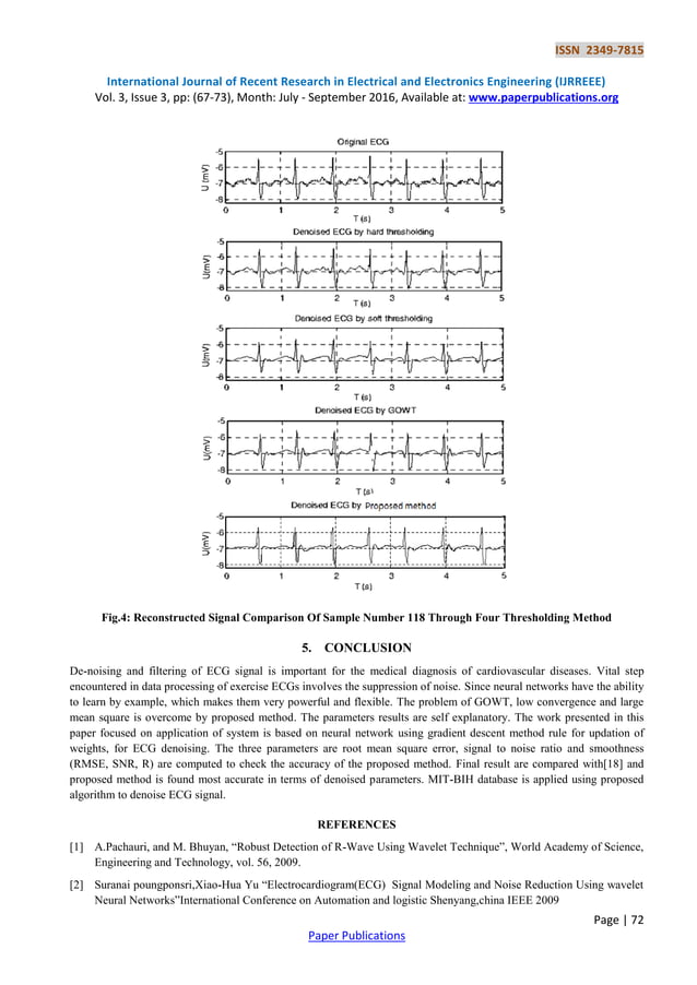 A new approach for Reducing Noise in ECG signal employing Gradient Descent Method by Artificial ...