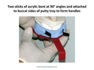 A new approach to indirect bonding /certified fixed orthodontic courses ...