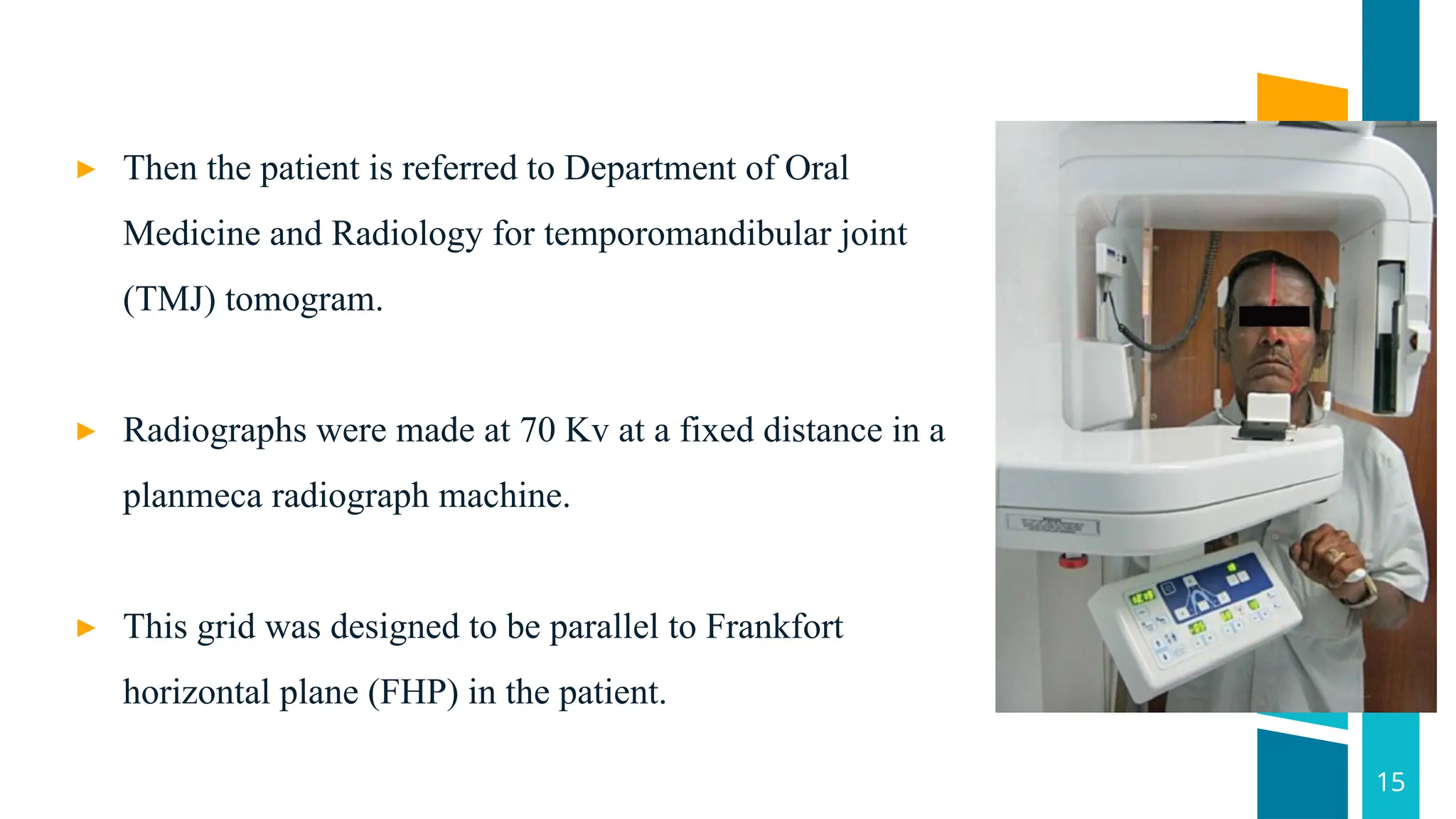 A newer technique to program a semi adjustable articulator.pptx