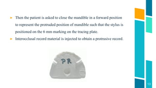 A newer technique to program a semi adjustable articulator.pptx