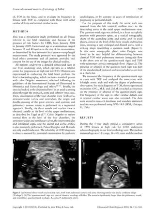 A new ultrasound marker of tetralogy of fallot | PDF