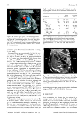 A new ultrasound marker of tetralogy of fallot | PDF