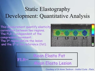 A new Ultrasound modality Elastography.ppt