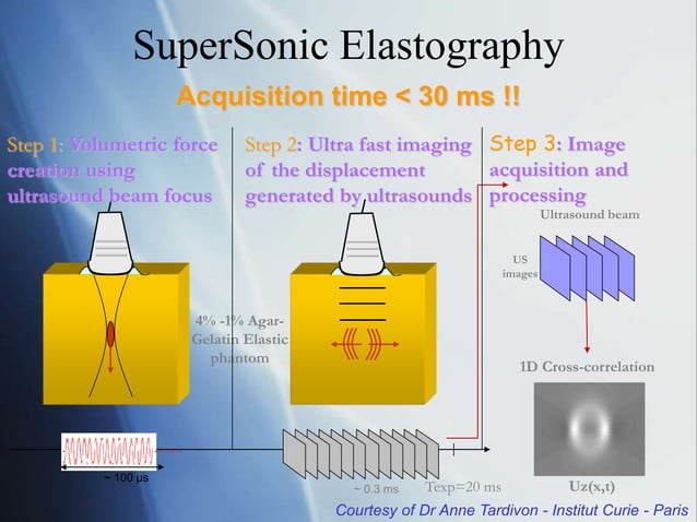 A new Ultrasound modality Elastography.ppt