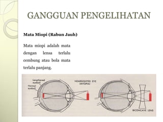 Sistem Penglihatan | PPTX