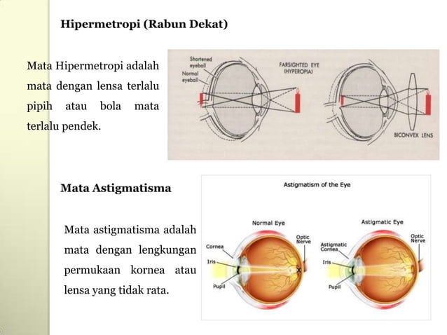 Sistem Penglihatan | PPTX