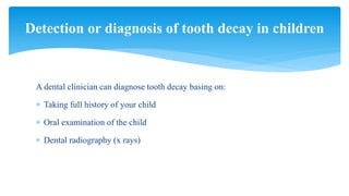 Tooth decay in children | PPTX