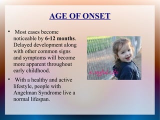 Angelman | PPT