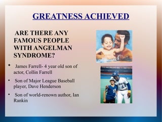 Angelman | PPT