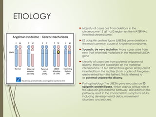ANGELMAN SYNDROME - introduction and summary.pptx