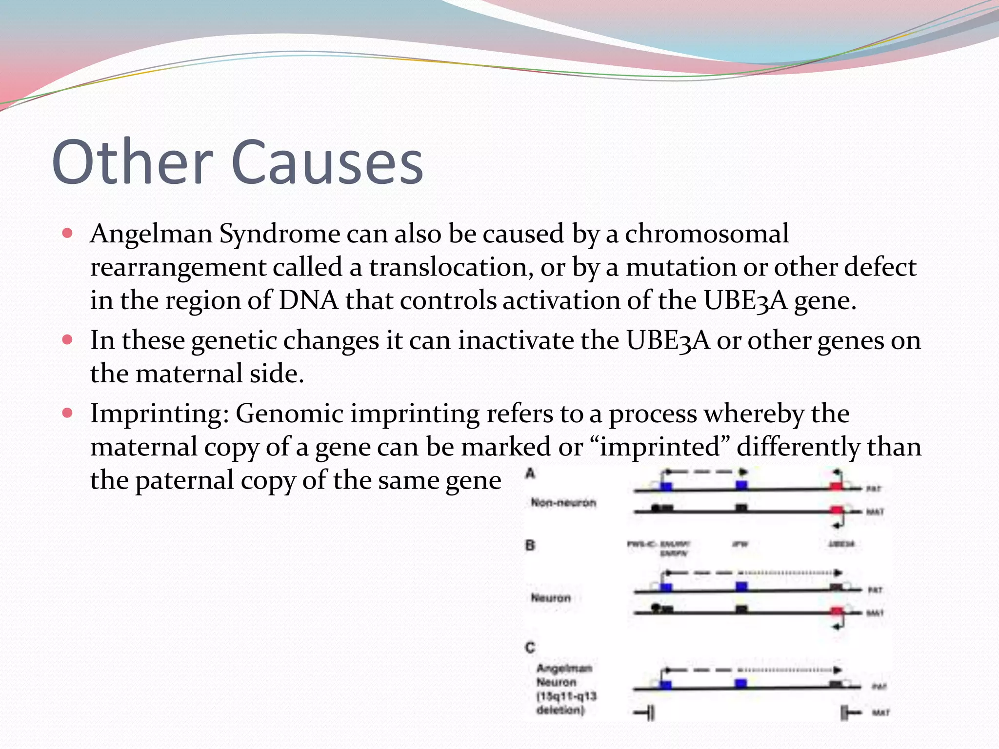 Angelman syndrome | PPTX