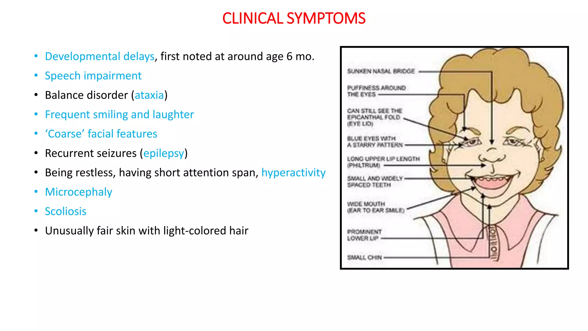 Angelman Syndrome | PPTX