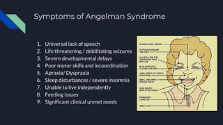 Angelman syndrome | PPTX