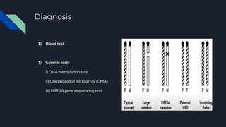 Angelman syndrome | PPTX