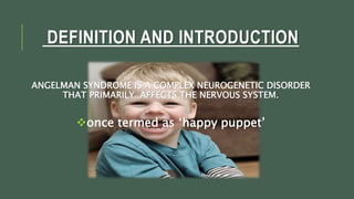 Angelman syndrome assignment | PPTX