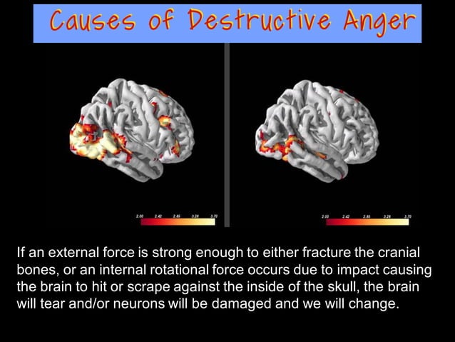 Anger Management from a Biblical Perspective | PPT