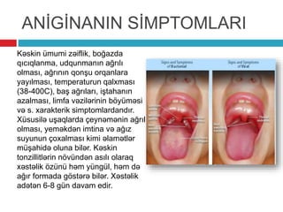 Angina | PPTX