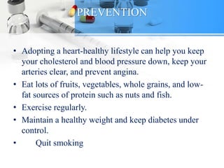 Angina | PPTX