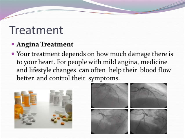 angina.ppt