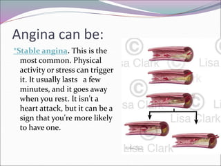 angina.ppt | Heart and Cardiovascular Diseases | Diseases and Conditions