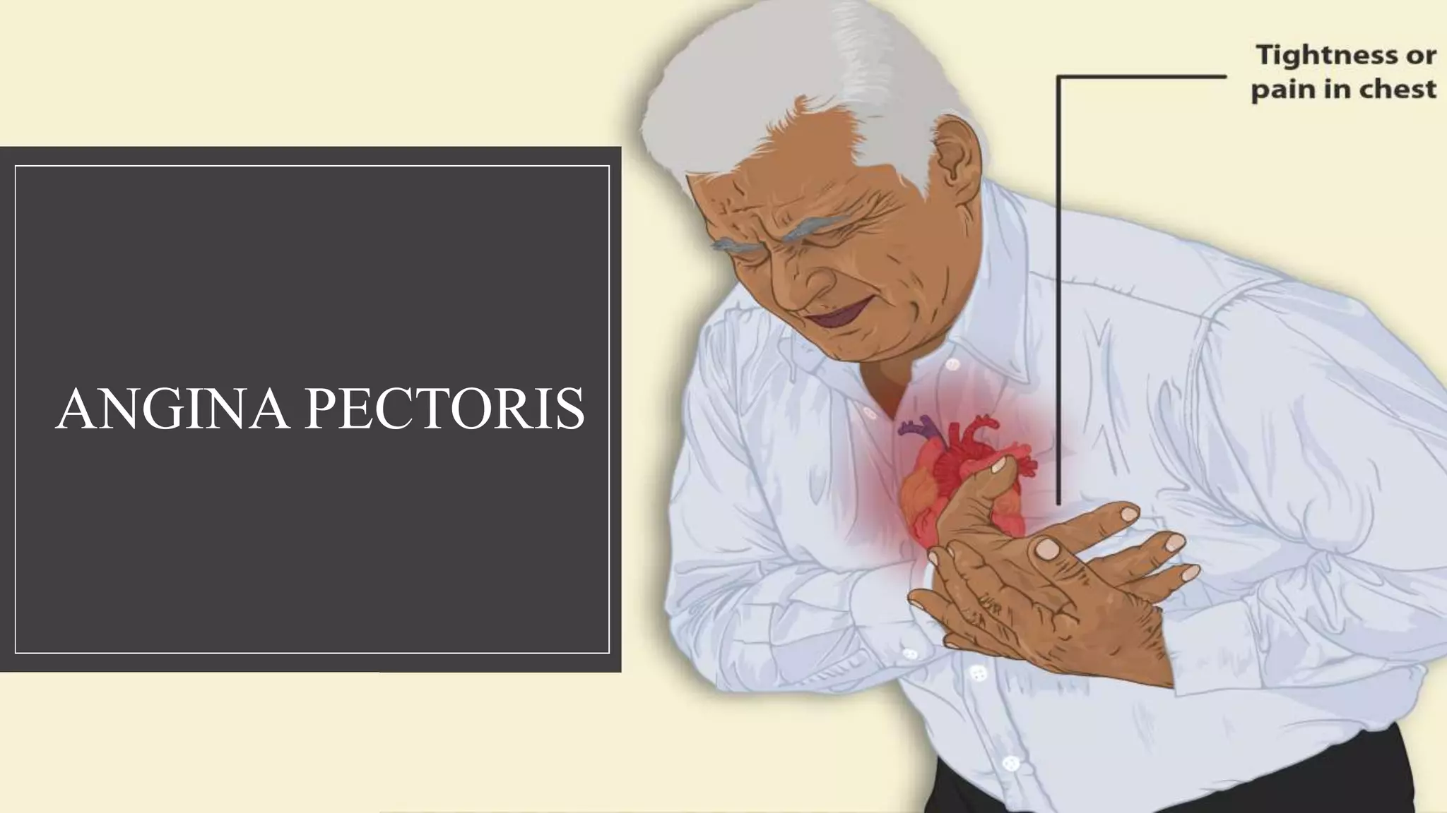 angina.pptx | Heart and Cardiovascular Diseases | Diseases and Conditions