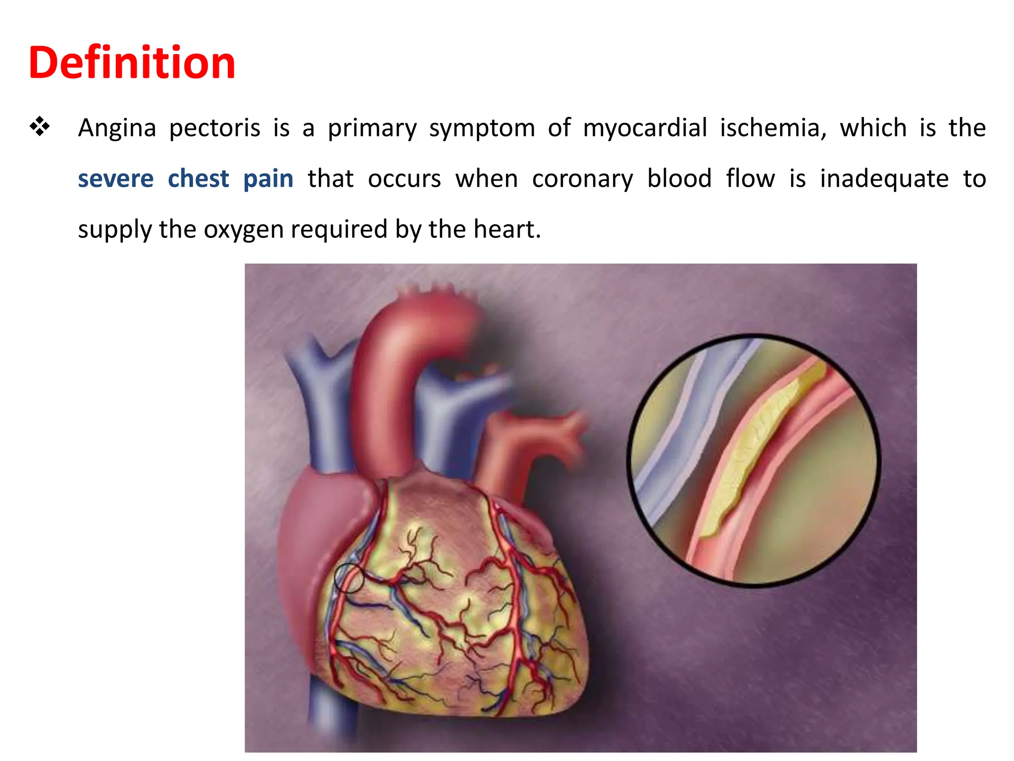 Pathophysiological approach of Angina Pectoris | PPTX