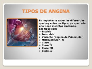 Angina de-pecho | PPTX