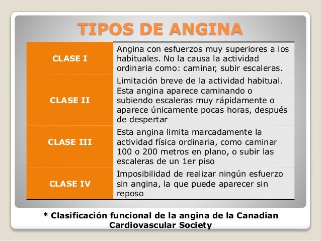 Angina de-pecho