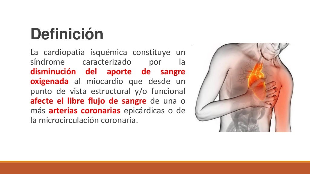 Cardiopatía isquémica: Angina estable e inestable