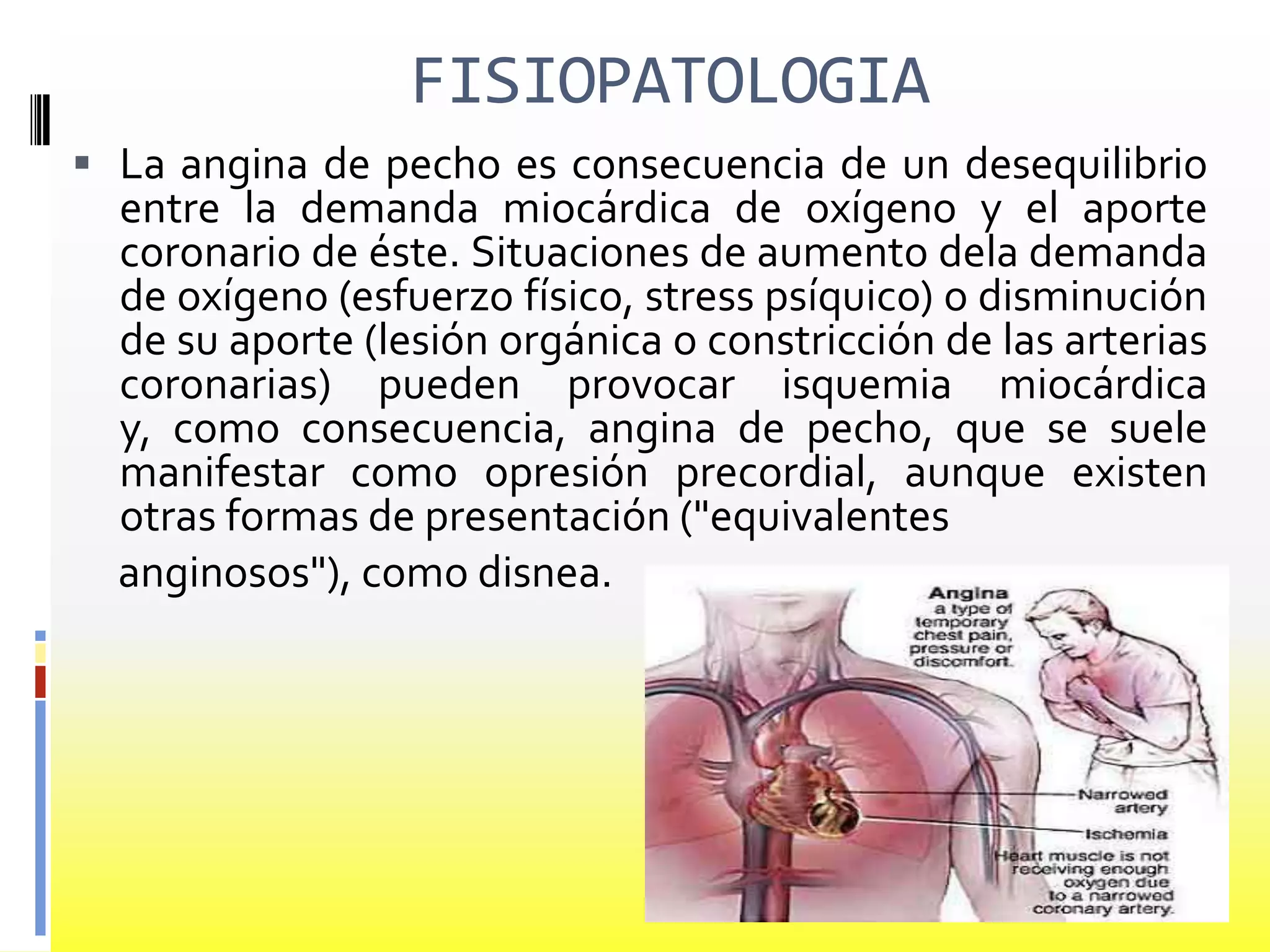 Angina de pecho | PPTX
