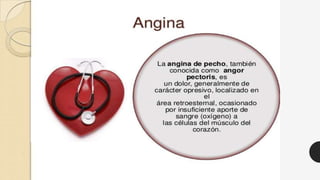 Angina de pecho | PPTX