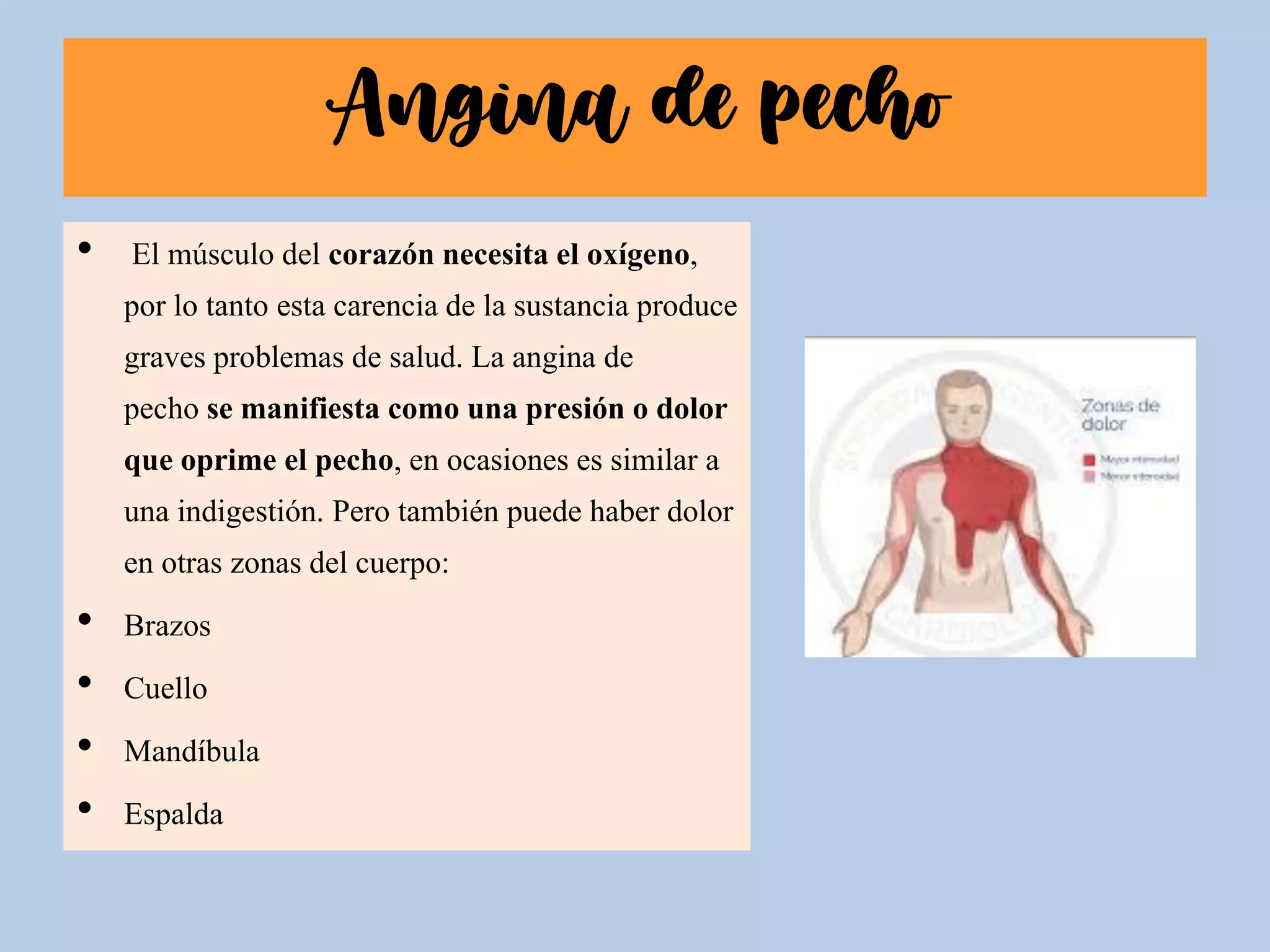 ANGINA DE PECHO / ANGOR PECTORIS ESTABLE E INESTABLE | PPT