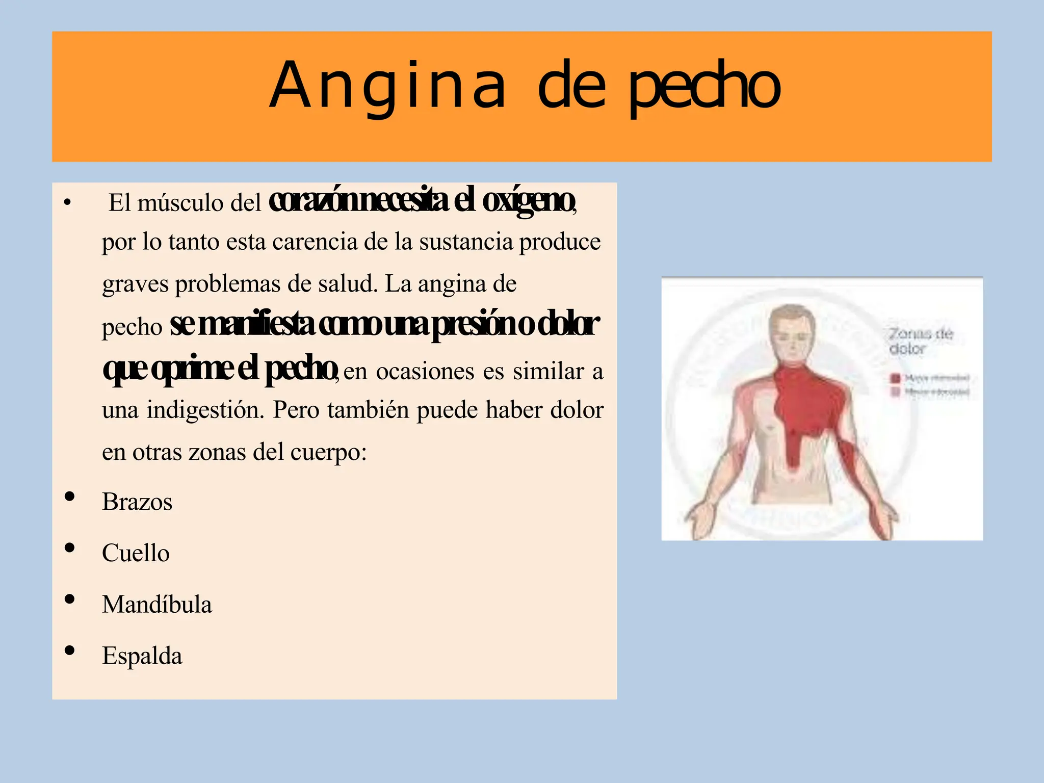 sintomatologia de angina de pecho en fisioterapia | PPT