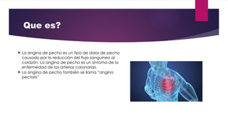 Angina de pecho, presentación, diapositivas | PPTX