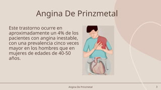 Angina De Prinzmetal Tema de Cardiología | PPTX