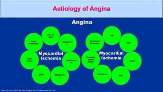 Angina diamond approach | PPT