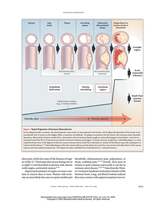 Angina estable | PDF | Heart and Cardiovascular Diseases | Diseases and ...